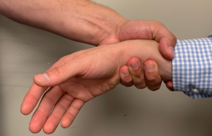 de Quervain Tenosynovitis | PM&R KnowledgeNow