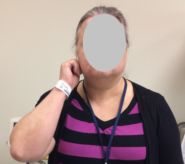 Cervical Dystonia | PM&R KnowledgeNow