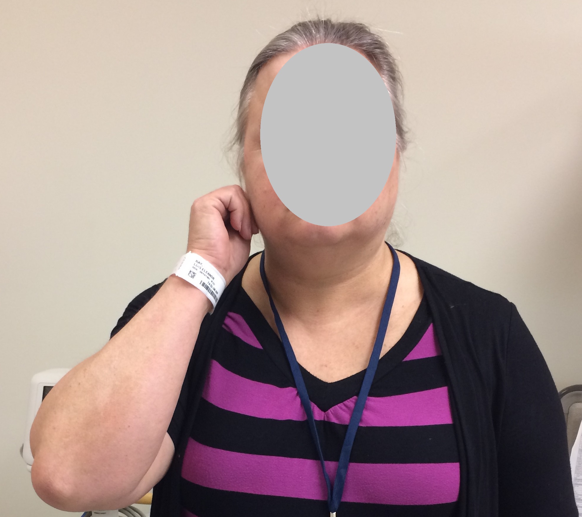 Cervical Dystonia | PM&R KnowledgeNow