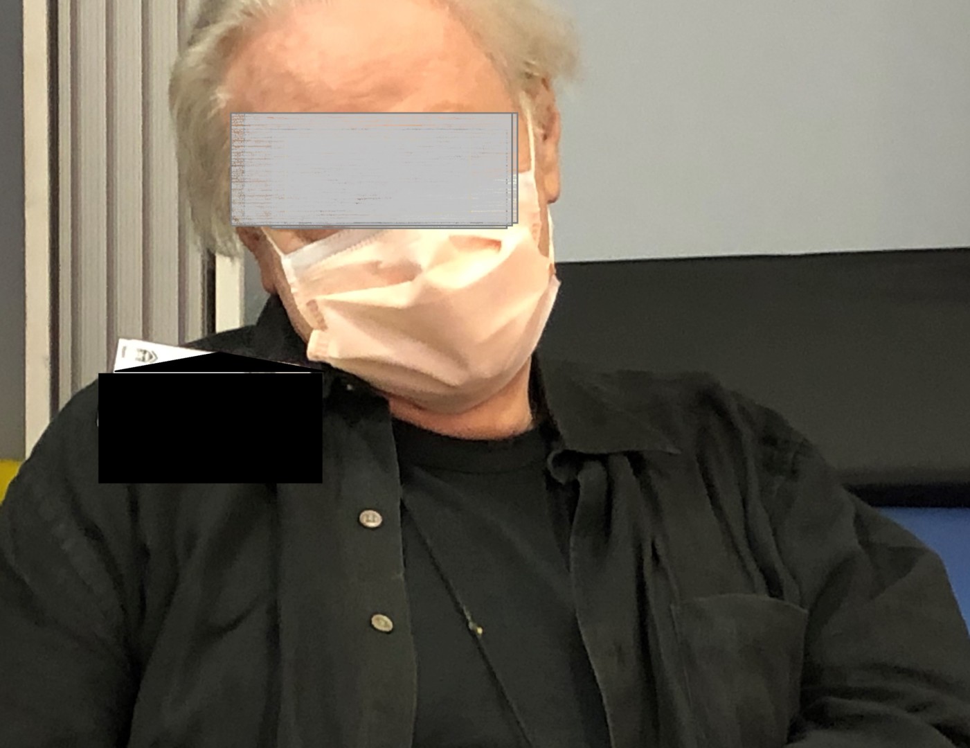 Cervical Dystonia | PM&R KnowledgeNow