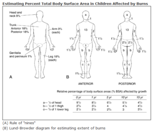 Pediatric Burns | PM&R KnowledgeNow
