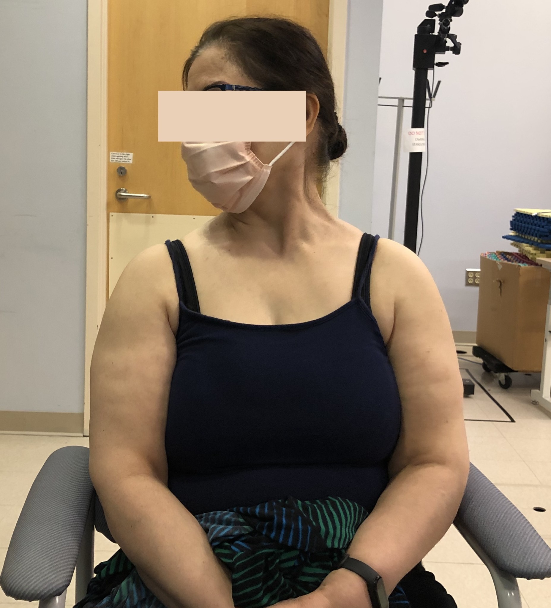 Cervical Dystonia | PM&R KnowledgeNow