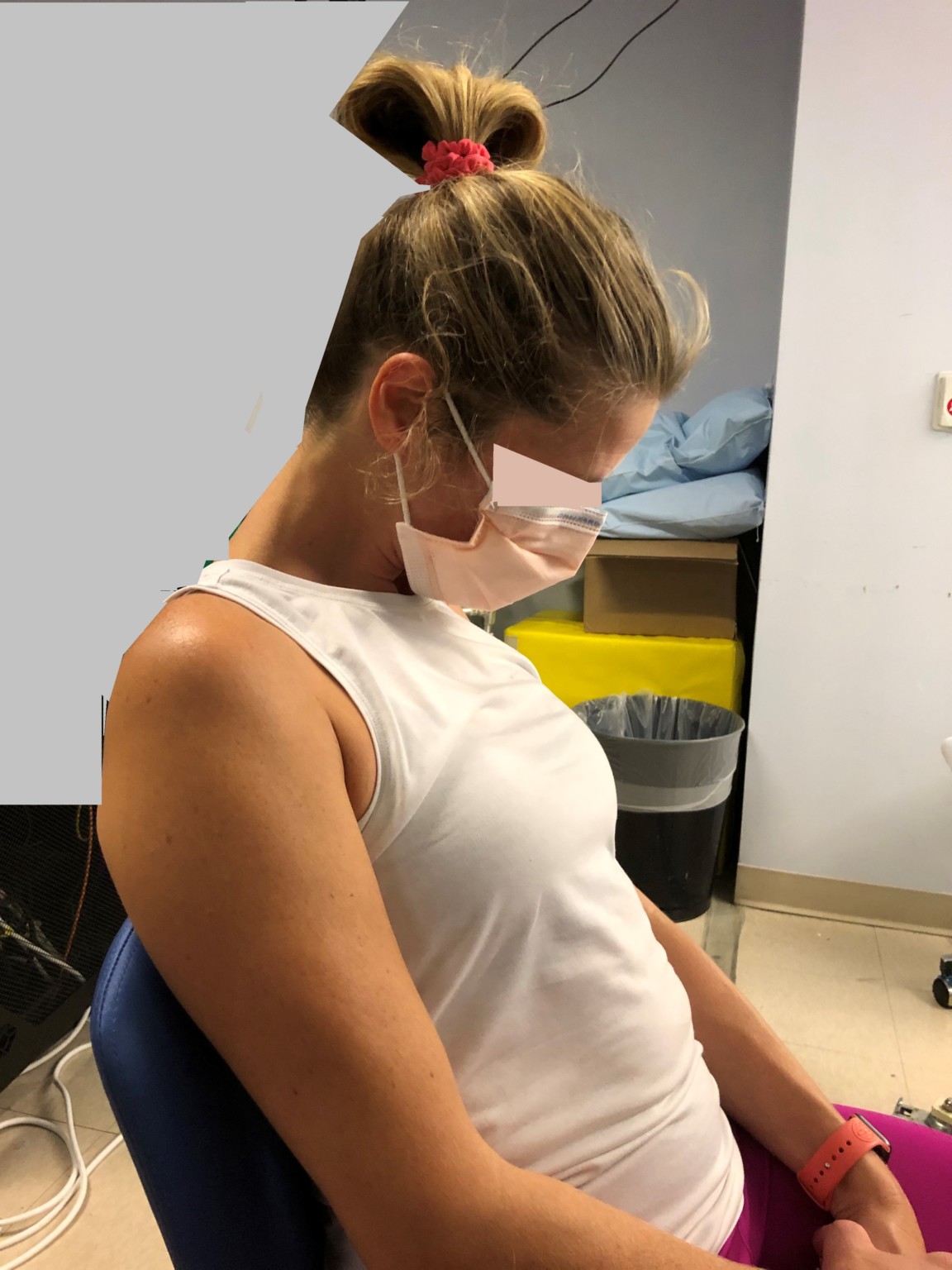 Cervical Dystonia | PM&R KnowledgeNow